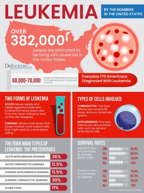 InformativeInsight.com | Understanding Leukemia Treatment: All You Need to Know